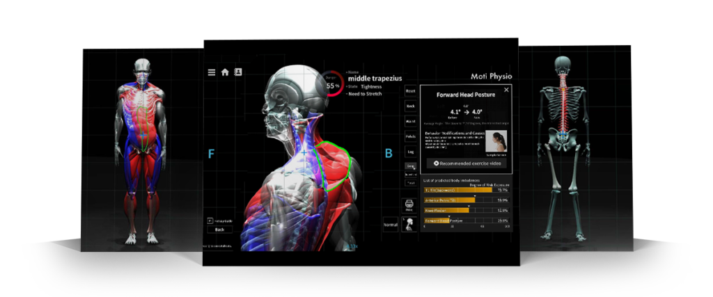 3D Posture Analyzer วิเคราะห์ร่างกายโดยไม่ต้อง X-ray| Belivwellness