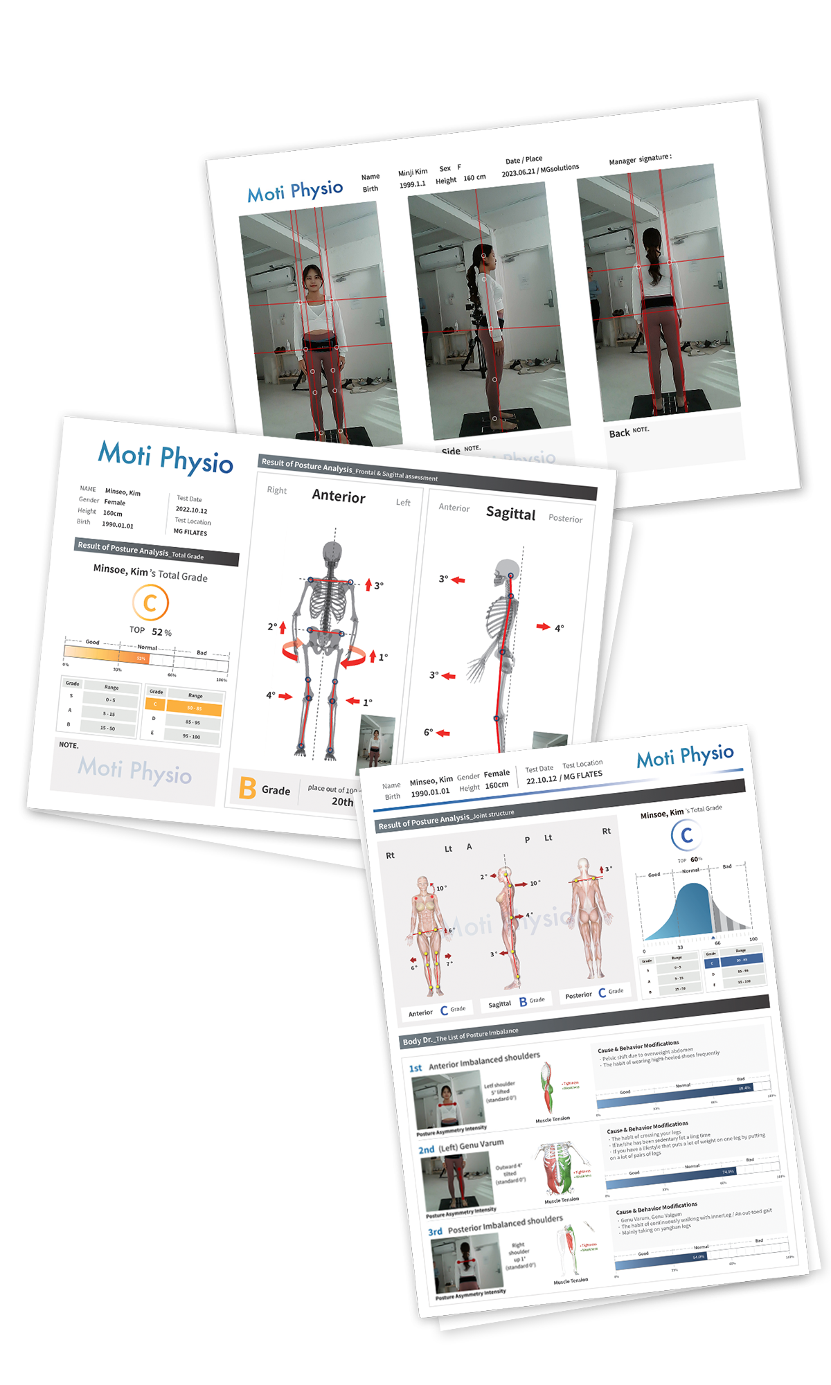 3D Posture Analyzer วิเคราะห์ร่างกายโดยไม่ต้อง X-ray| Belivwellness